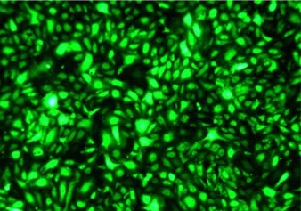 GFP Labeled Cells – UBPONE