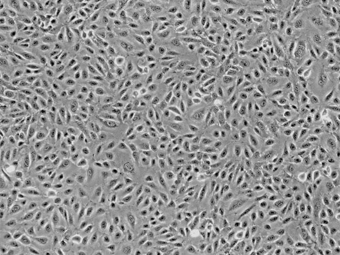 Aequorin Expressed in Mitochondria Cells Human Umbilical Vein Endothel ...